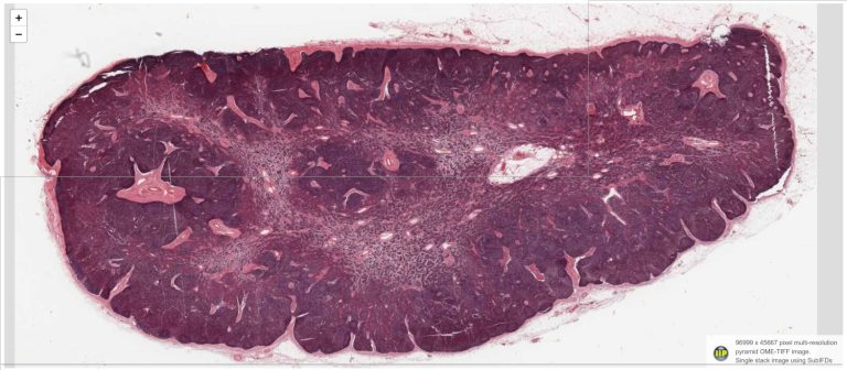 OME-TIFF Whole Slide Microscopy – IIPImage